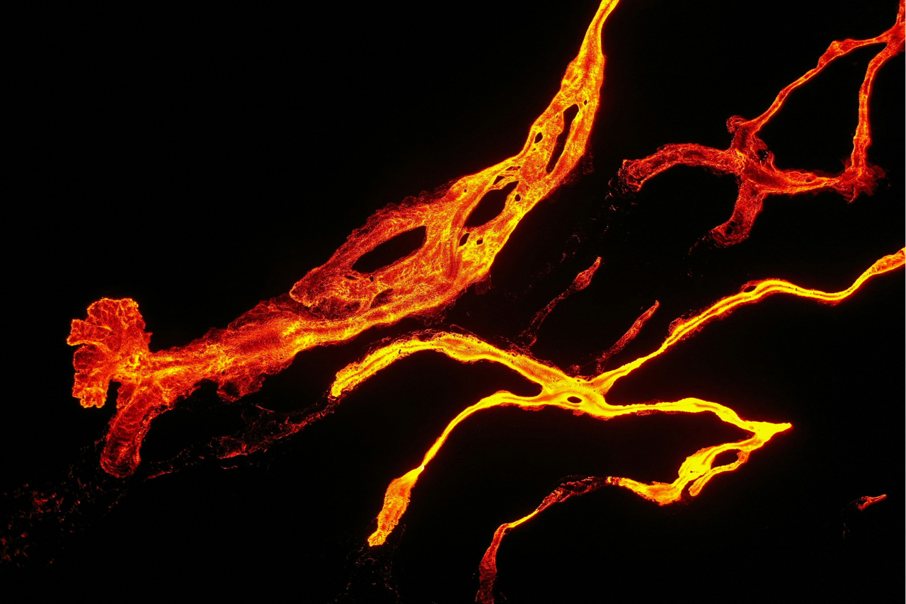 Scourged! | Renner Ministries